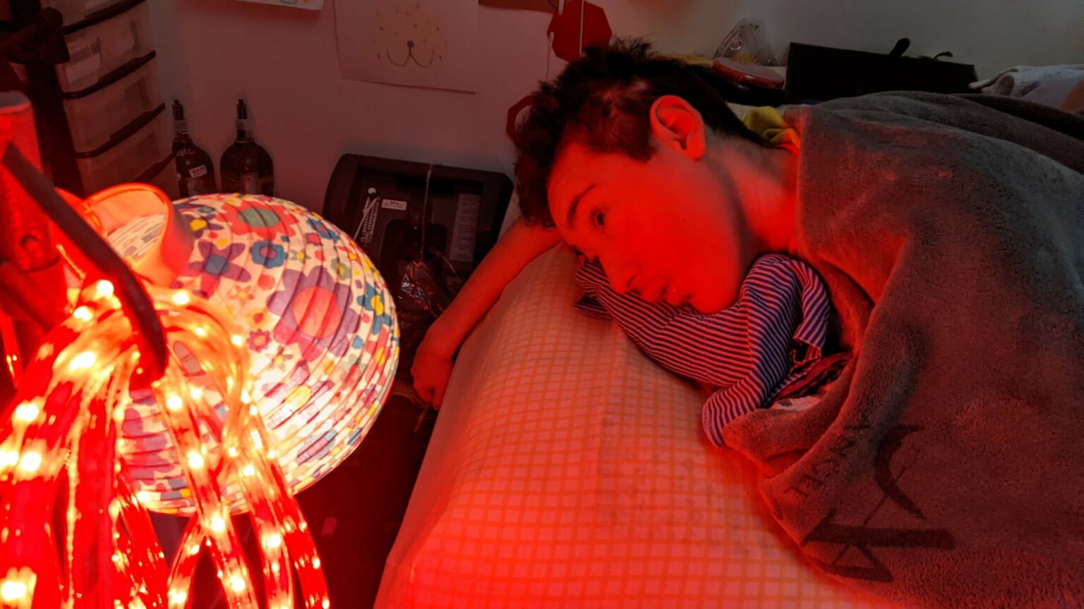 The Inchstone Project: Advancing Outcome Measures for Severe DEE Patients